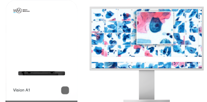 Vision automated analysis systems and medical software for clinical ...